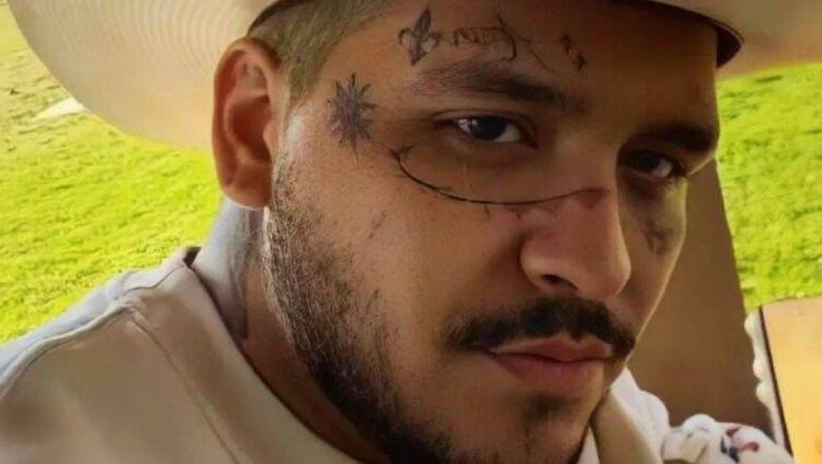 Así Luce Christian Nodal Tras Tratamiento Para Quitarse Tatuajes De La